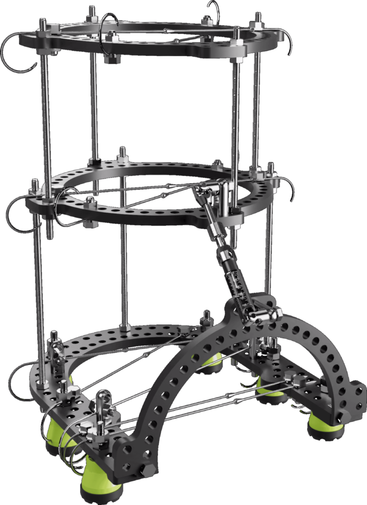 FusionFrame™ Circular Fixator - GLW Medical