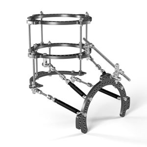 FusionFrame™ Circular Fixator - GLW Medical