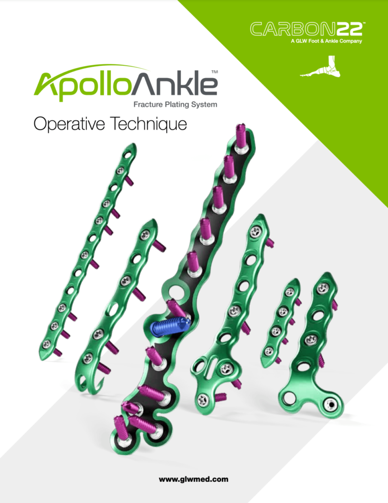 Apollo Ankle™ Fracture Plating System - GLW Medical Innovation