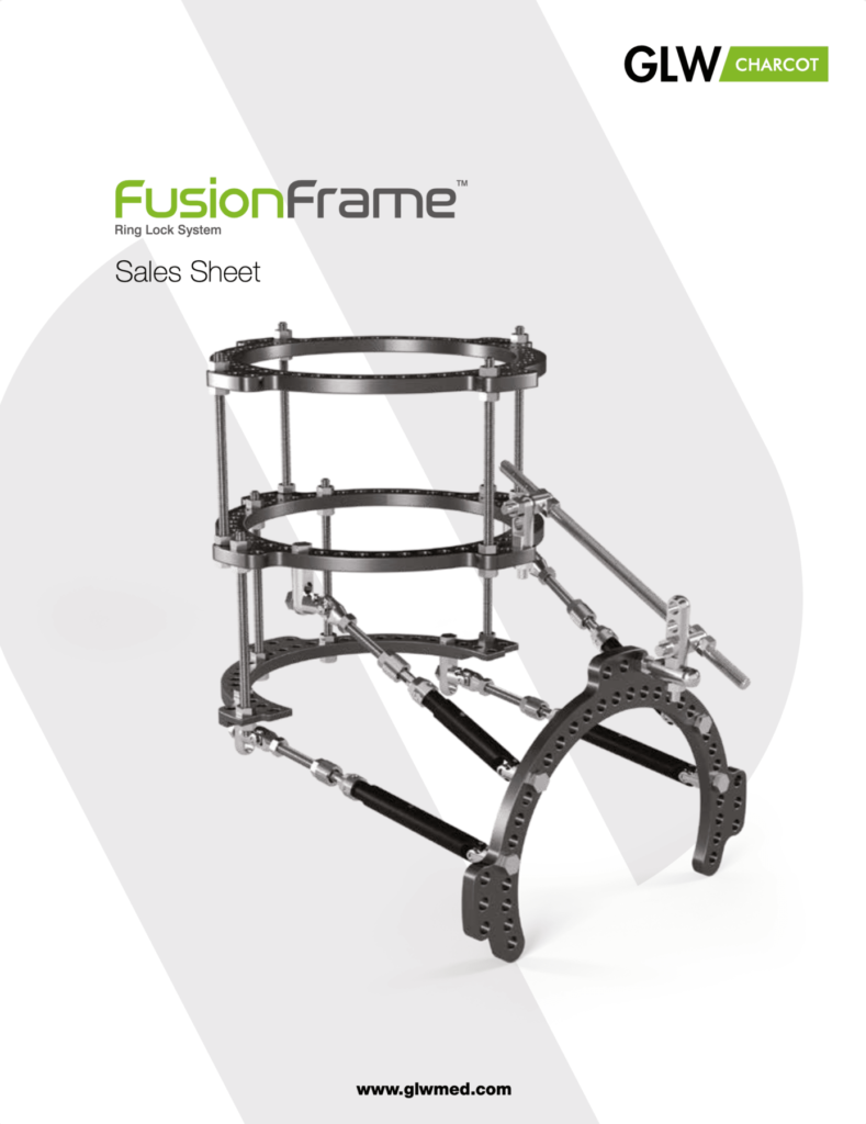 FusionFrame™ Circular Fixator - GLW Medical