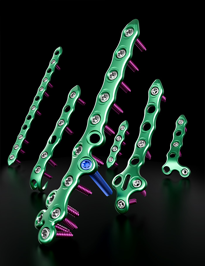 GLW Medical Announces Full Market Release of the Apollo Ankle Fracture ...
