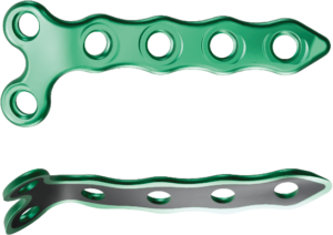 Apollo AFX™ Ankle Fracture Plating System - GLW Medical