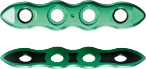 Apollo AFX™ Ankle Fracture Plating System - GLW Medical