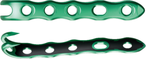 Apollo AFX™ Ankle Fracture Plating System - GLW Medical